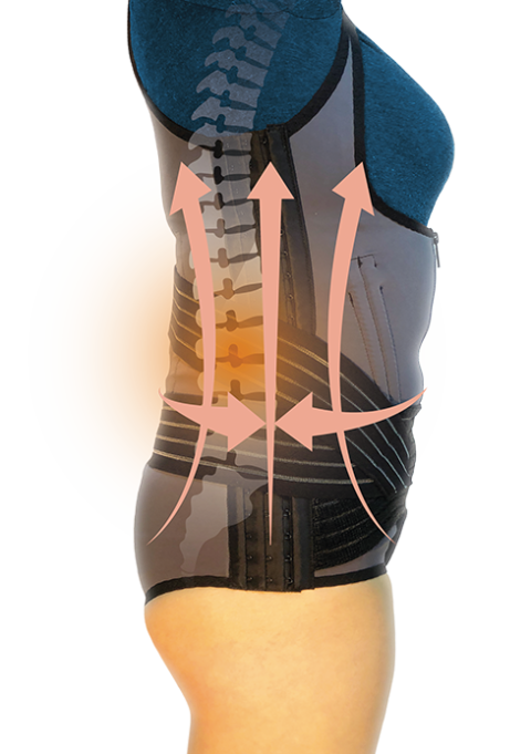Ceinture de maintien abdomino-lombaire sur-mesure - Bodynov